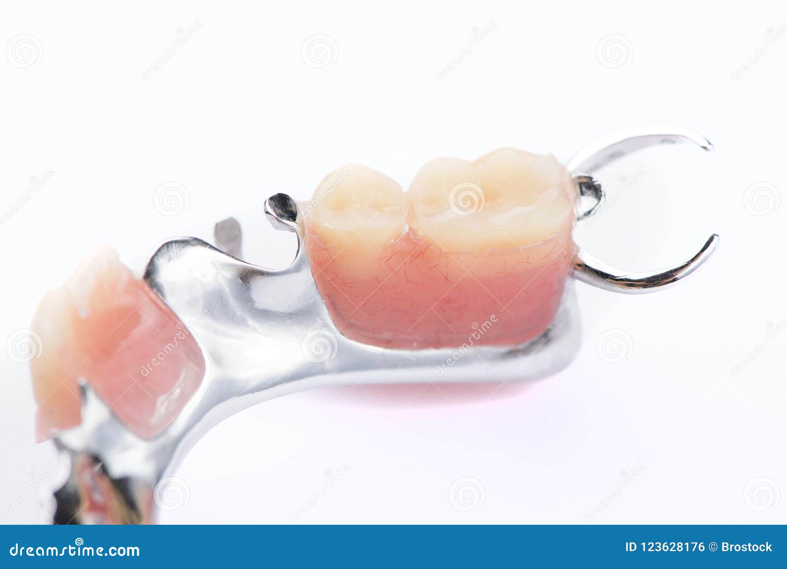 Close-up Lower Metal Denture on a White Background Stock Photo - Image ...