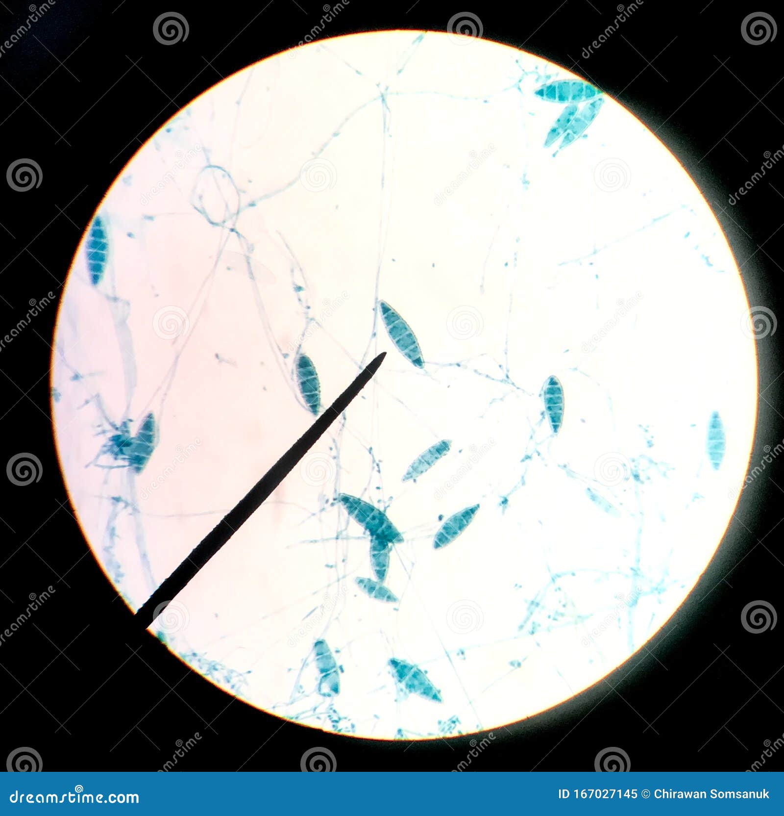 Close Up Macro Conidia of Fungi Stock Image - Image of filamentous ...