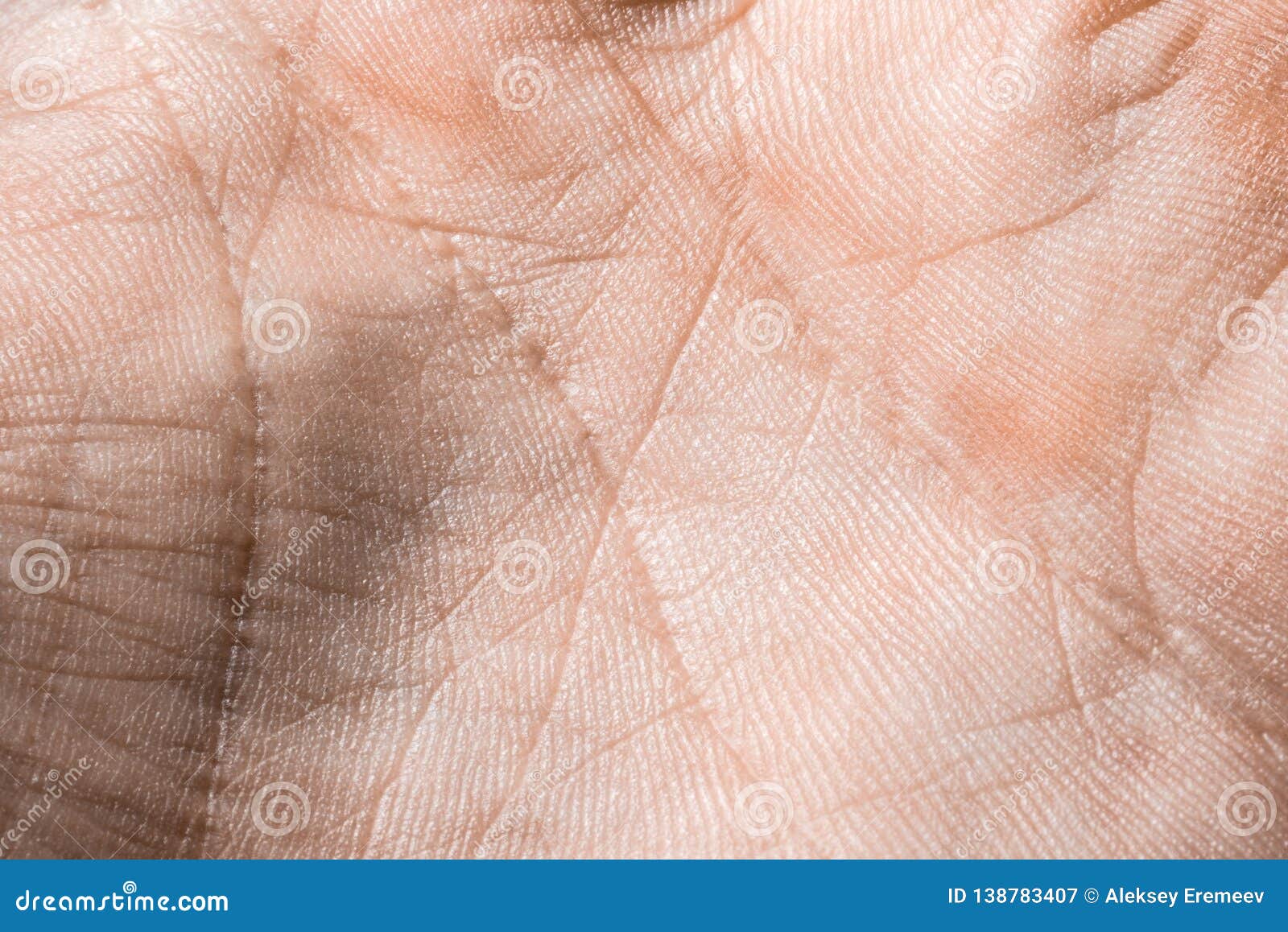 Close Up Macro Image of the Skin Surface Texture of Human Hands Palms ...