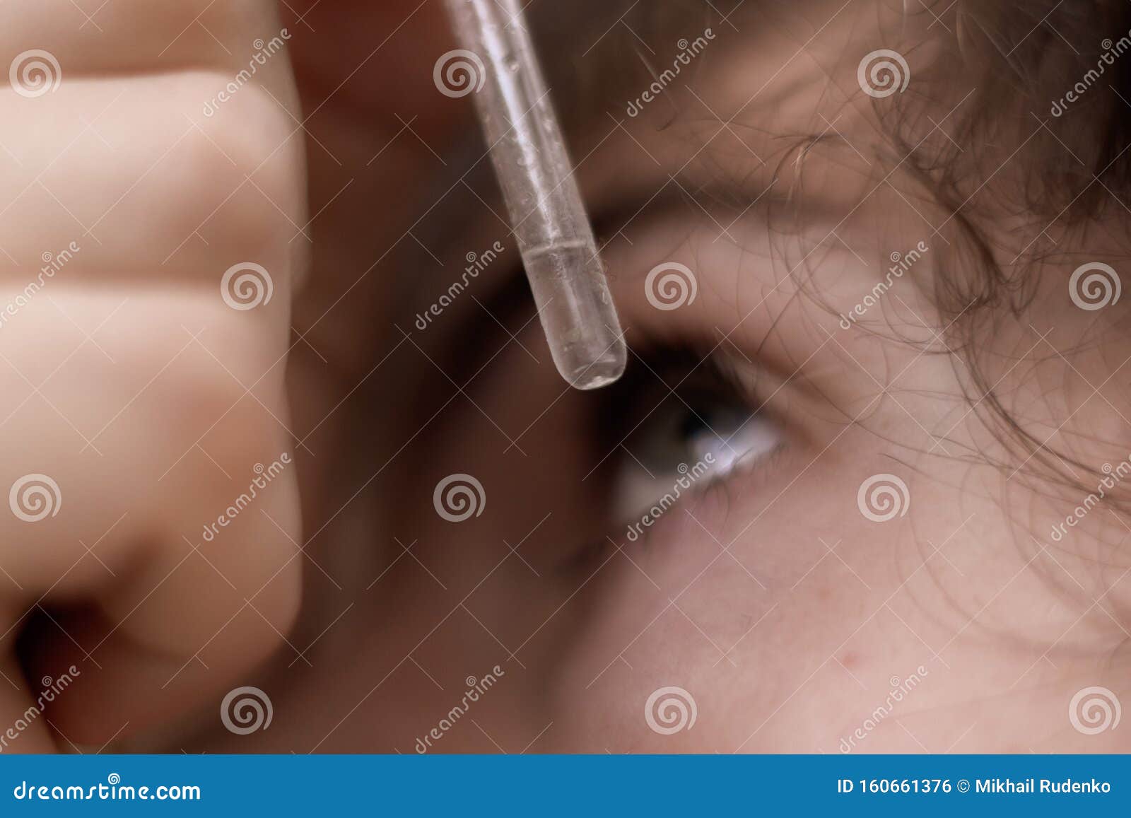 Close Up Man Drop Some Medicine Eye Drops, Treatment Process S Stock ...