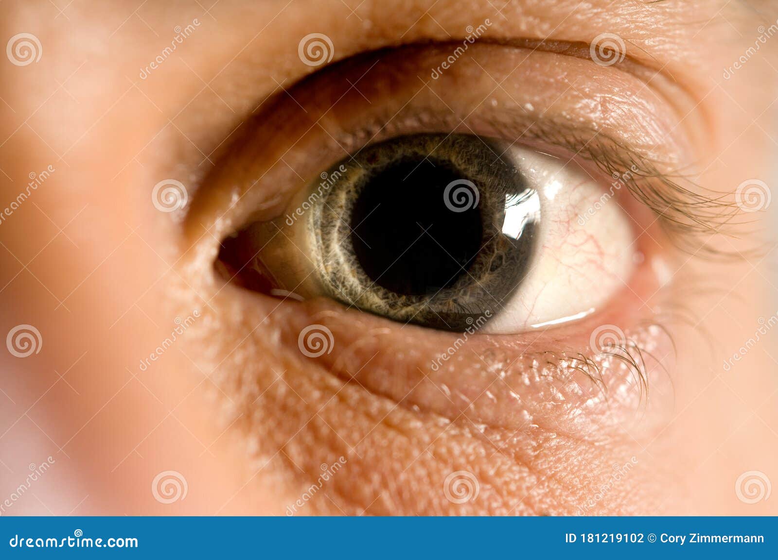 Close Up of a Man`s Eye Ball Stock Photo - Image of person, medical ...