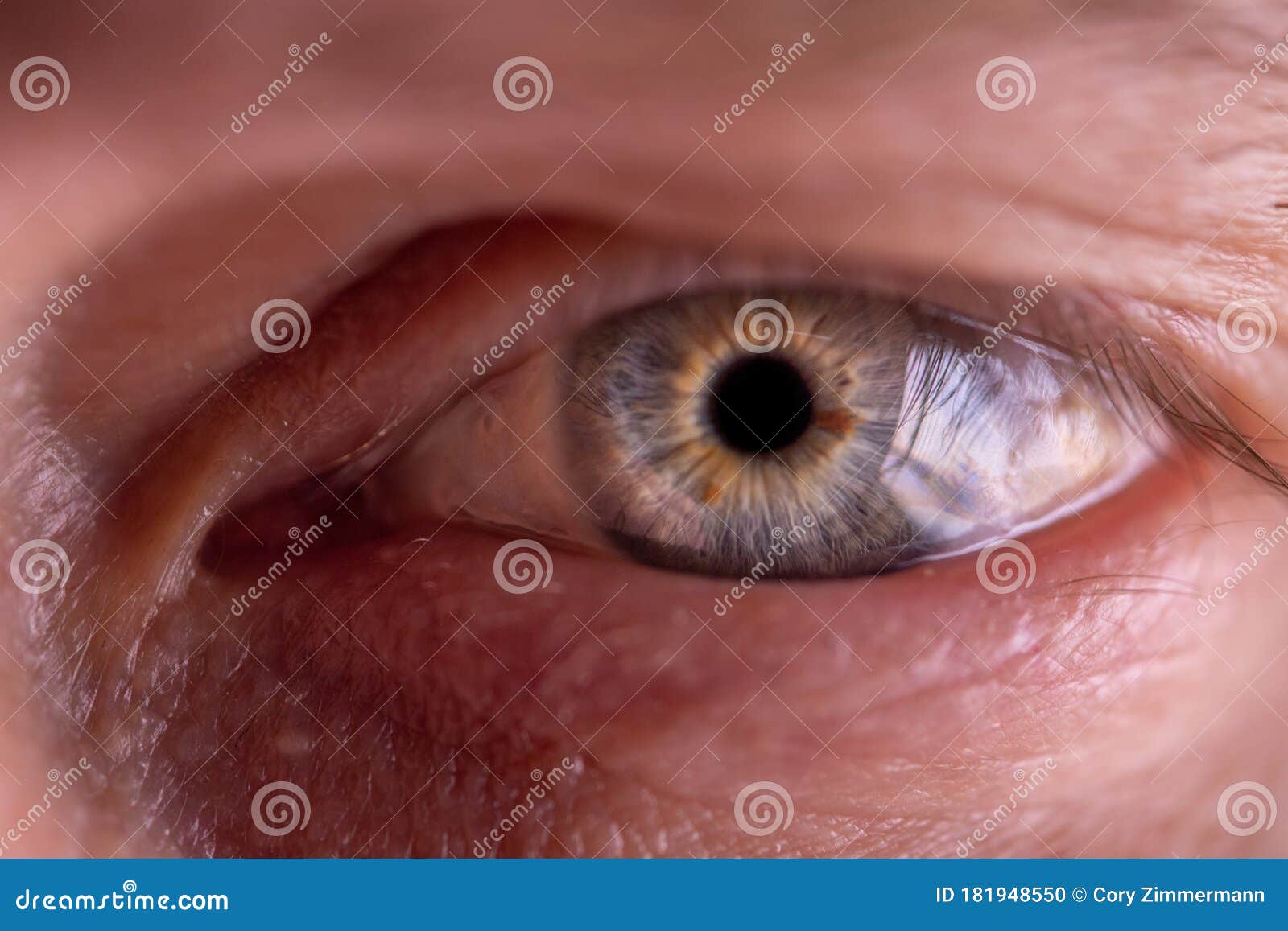 Close Up of a Man`s Eye Ball Stock Photo - Image of adult, healthy ...