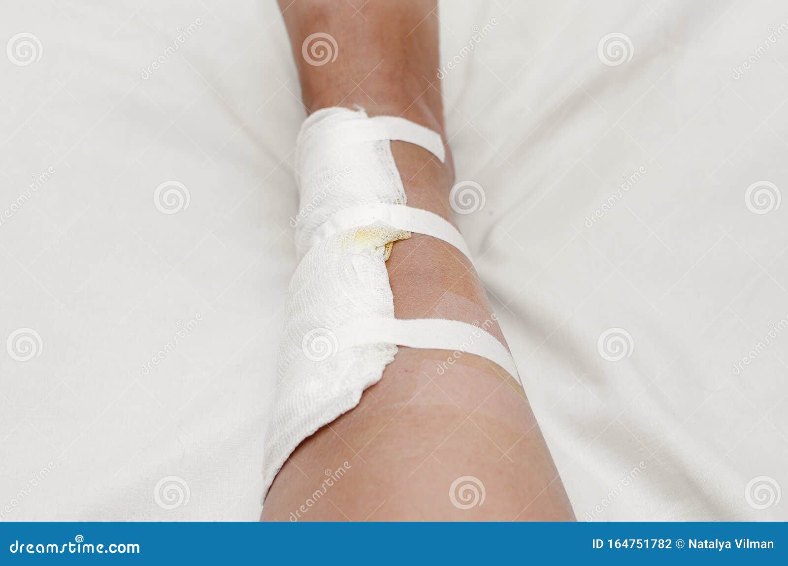 Close-up Medical Bandage on the Leg Stock Photo - Image of health, band ...