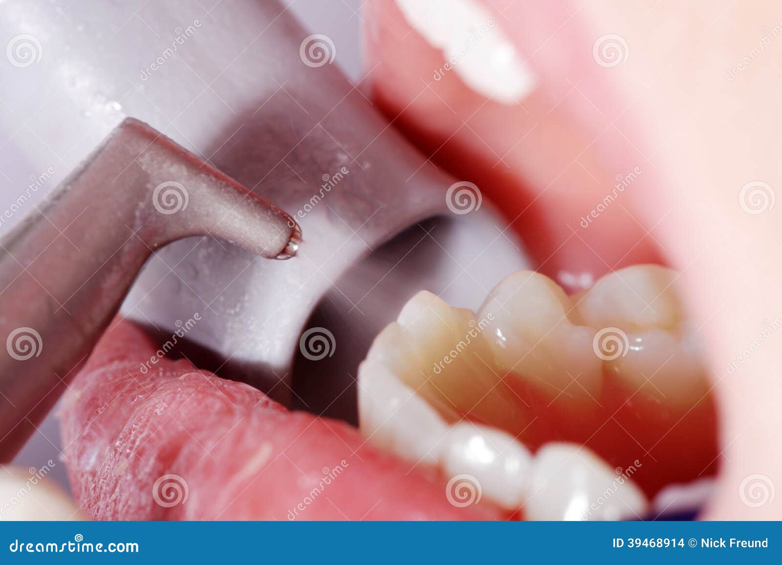 Close-up mouth and teeth stock photo. Image of beauty - 39468914