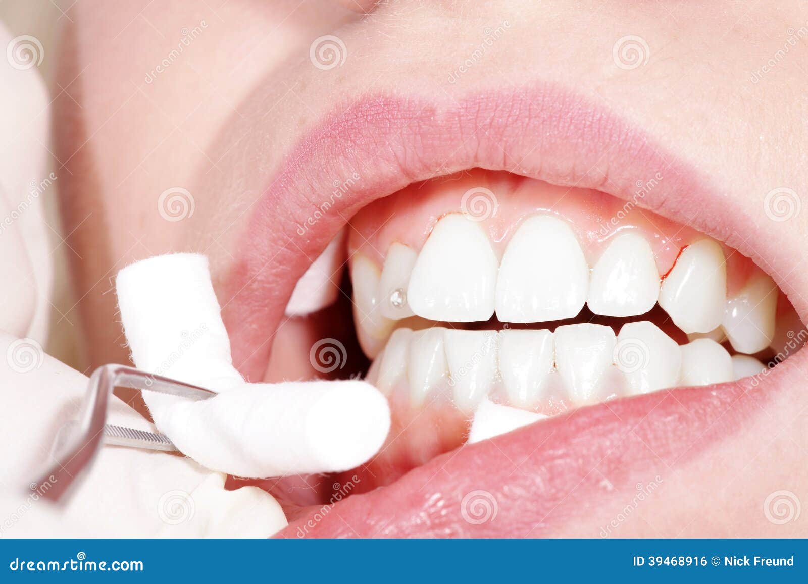 Close-up mouth and teeth stock photo. Image of lips, oral - 39468916