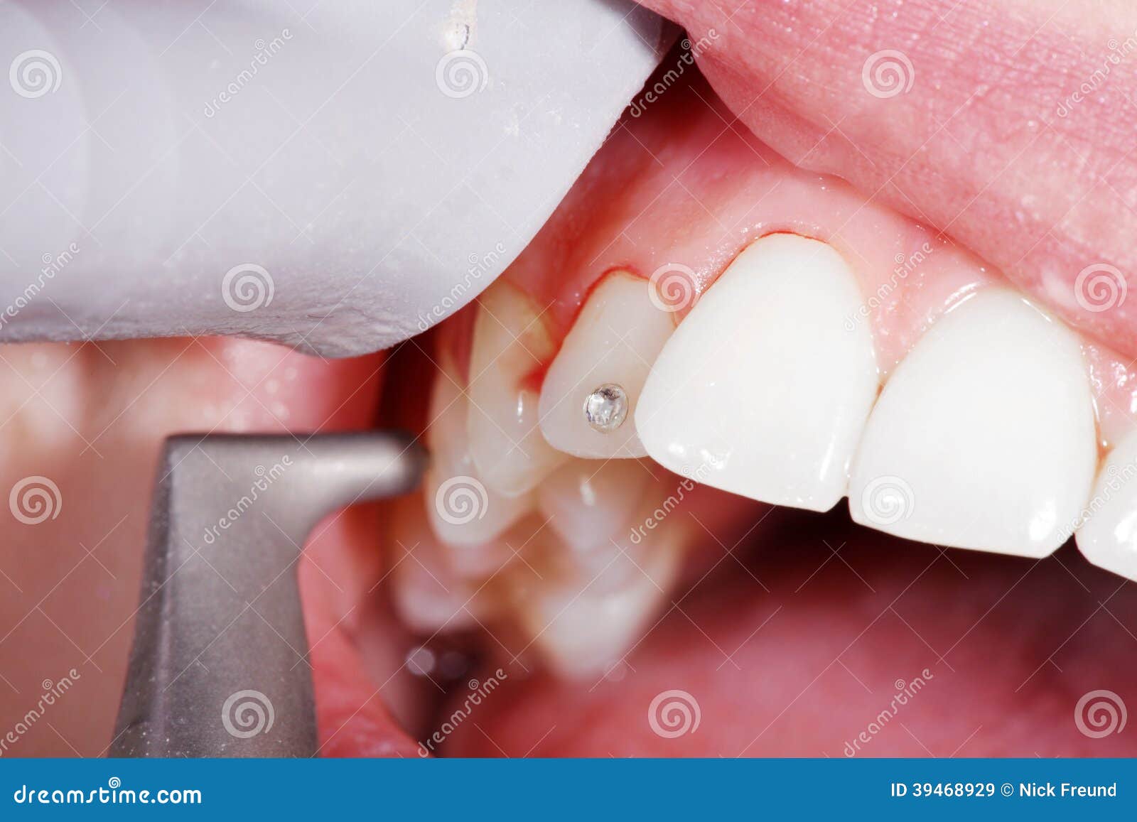 Close-up mouth and teeth stock image. Image of natural - 39468929