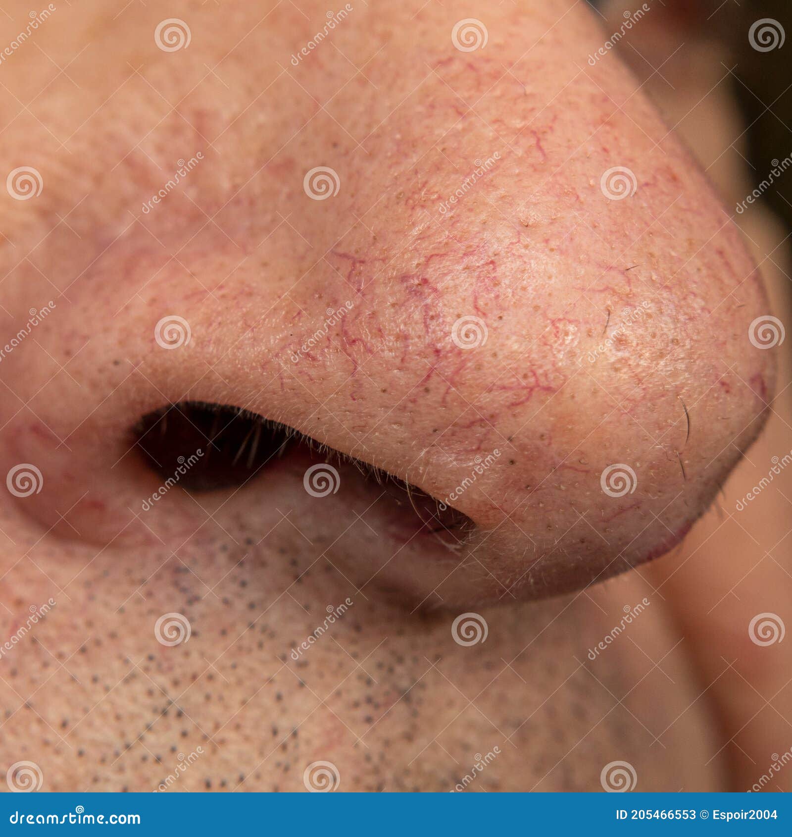 4,706 Old Man Nose Photos - Free & Royalty-Free Stock Photos from ...