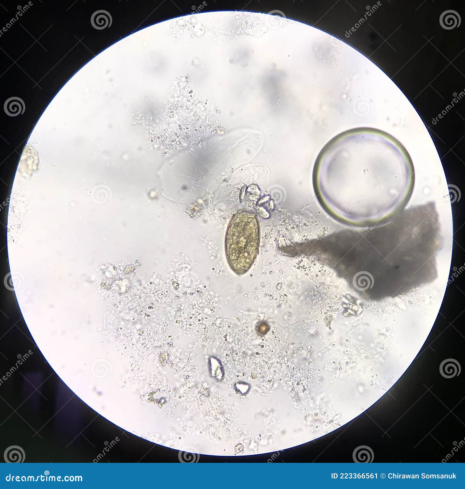 Close Up Parasite in Stool Exam. Stock Image - Image of medical ...