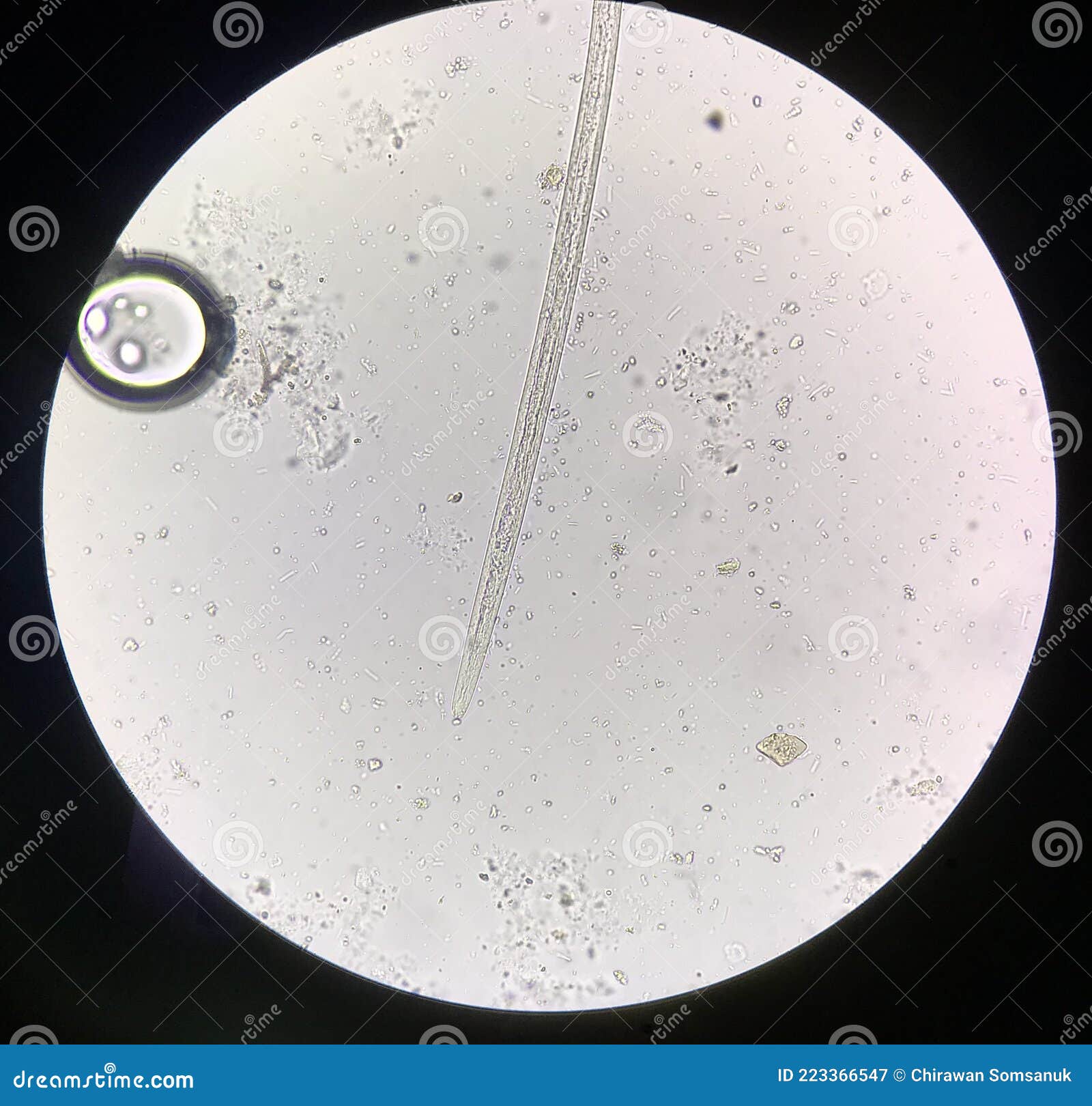 Close Up Parasite in Stool Exam. Stock Image - Image of close, sore ...