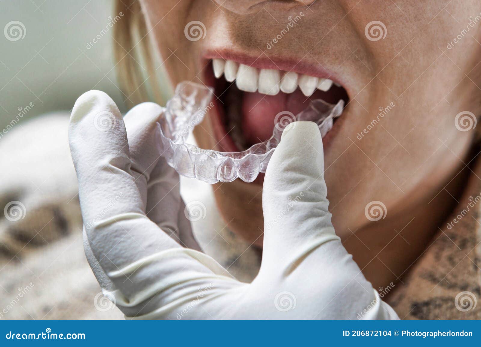 Close Up of Patient Getting Teeth Size Check by Dentist Stock Photo ...