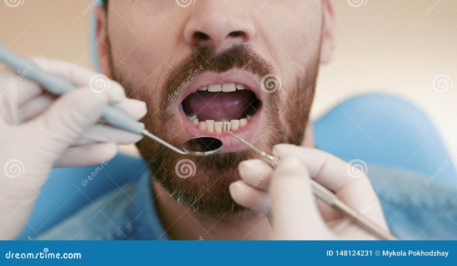 Close-up of Patient Open Mouth during Oral Checkup with Mirror Near by ...