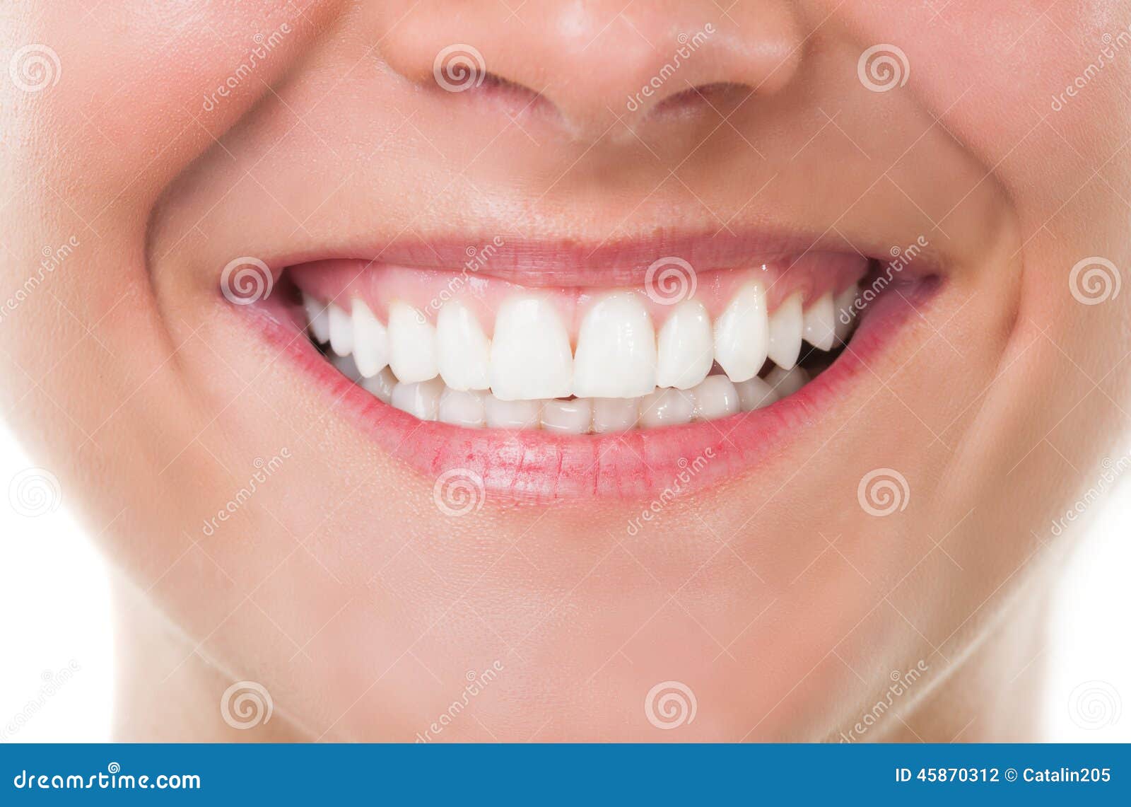 Close-up with Perfect Smile Stock Photo - Image of odontology, healthy ...