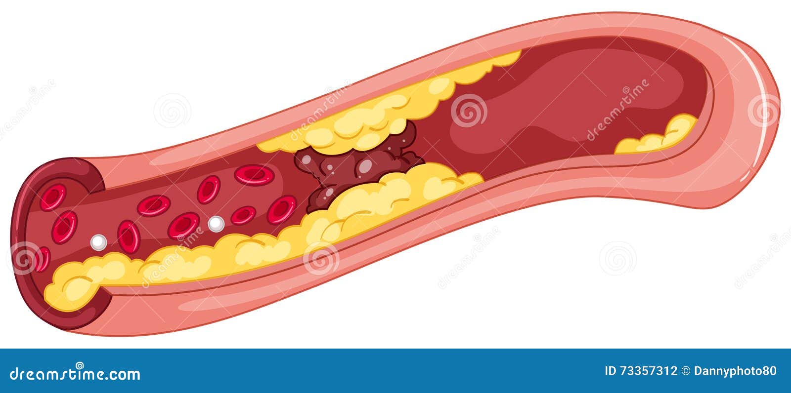 Close Up Red Blood Cells In The Veins Background 3D Illustration ...