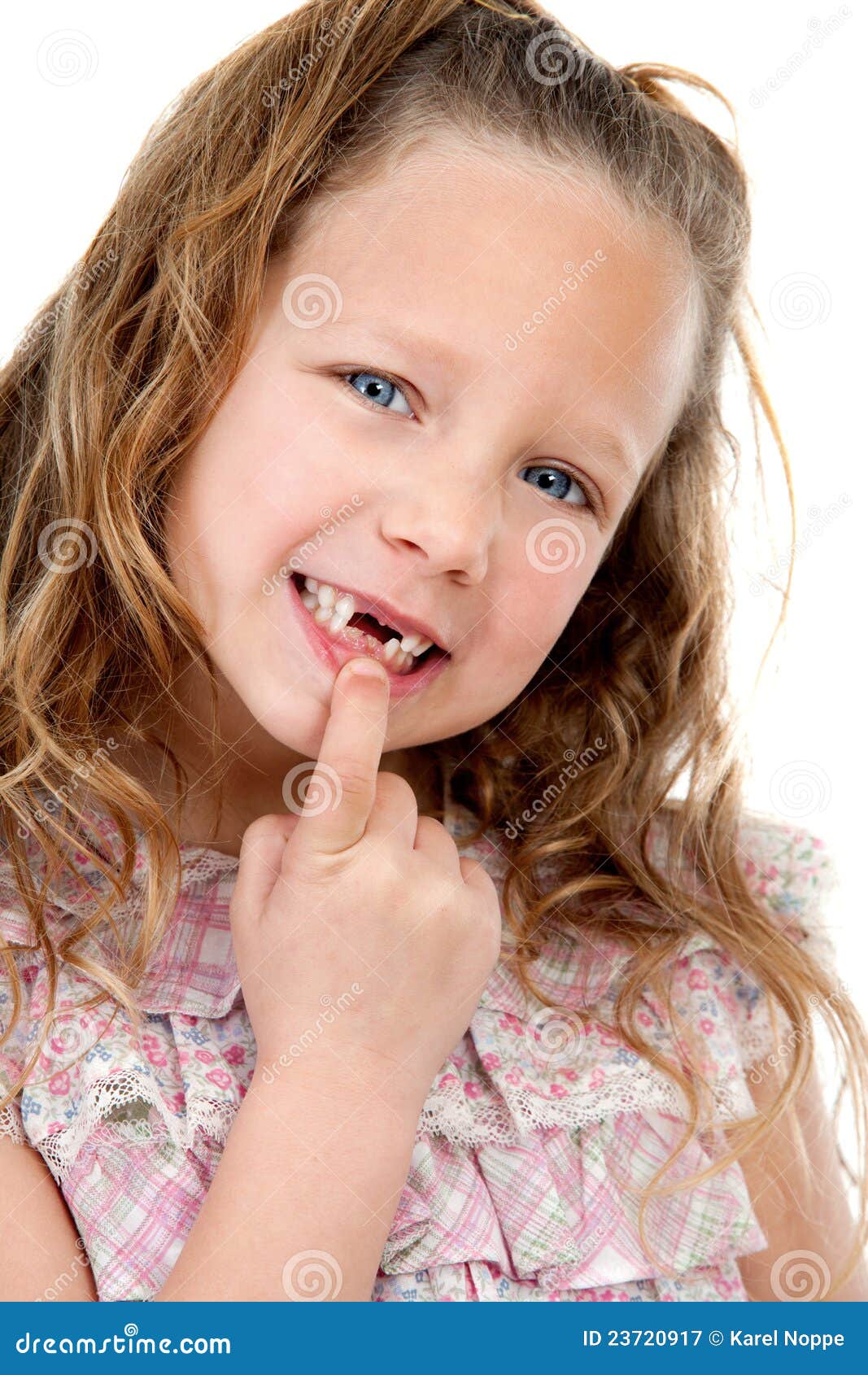 Close Up Portrait of Girl Showing Missing Teeth. Stock Image - Image of ...