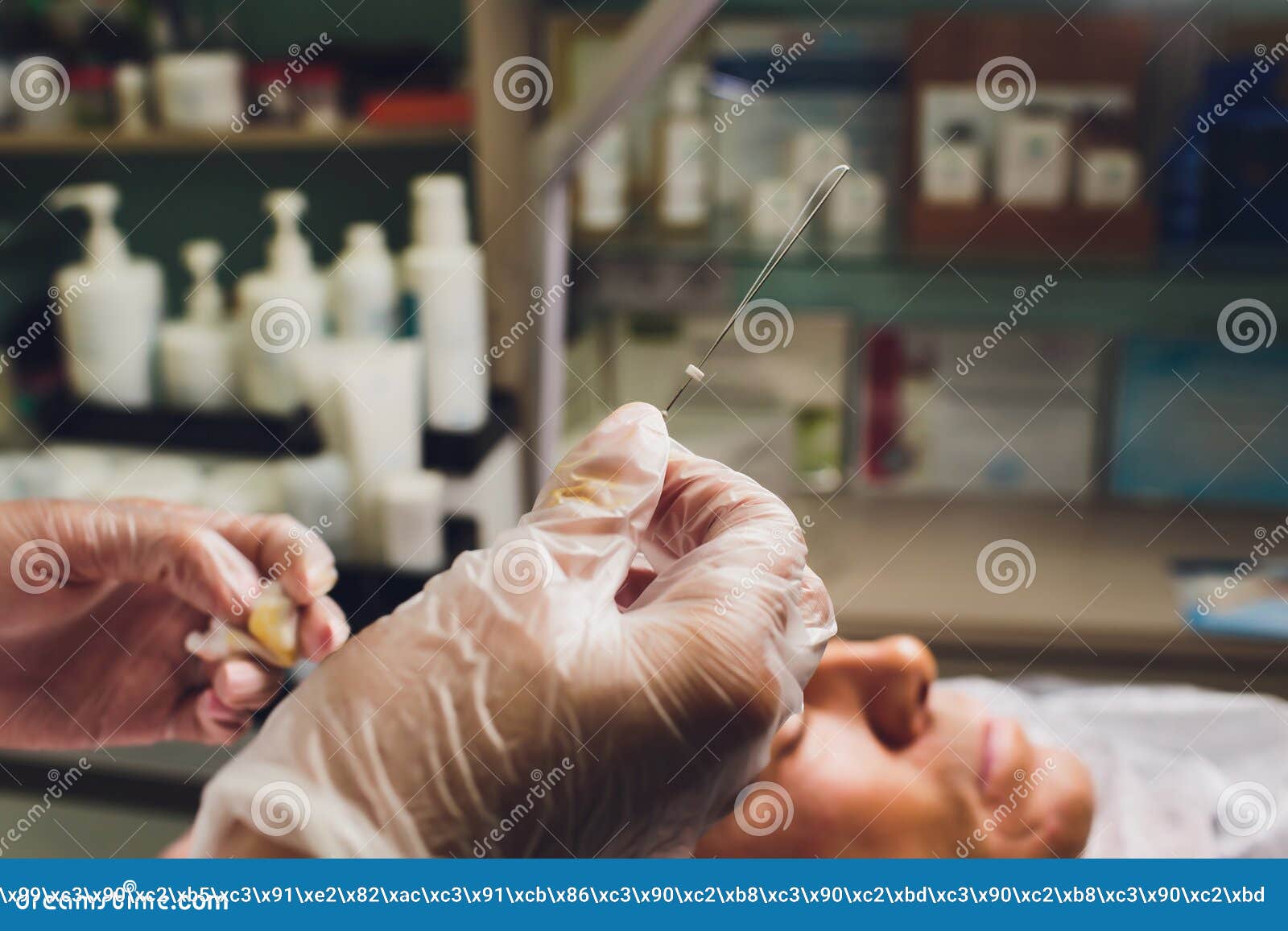 Close-up of Procedure for Face Lifting PDO Suture Operation, Face ...