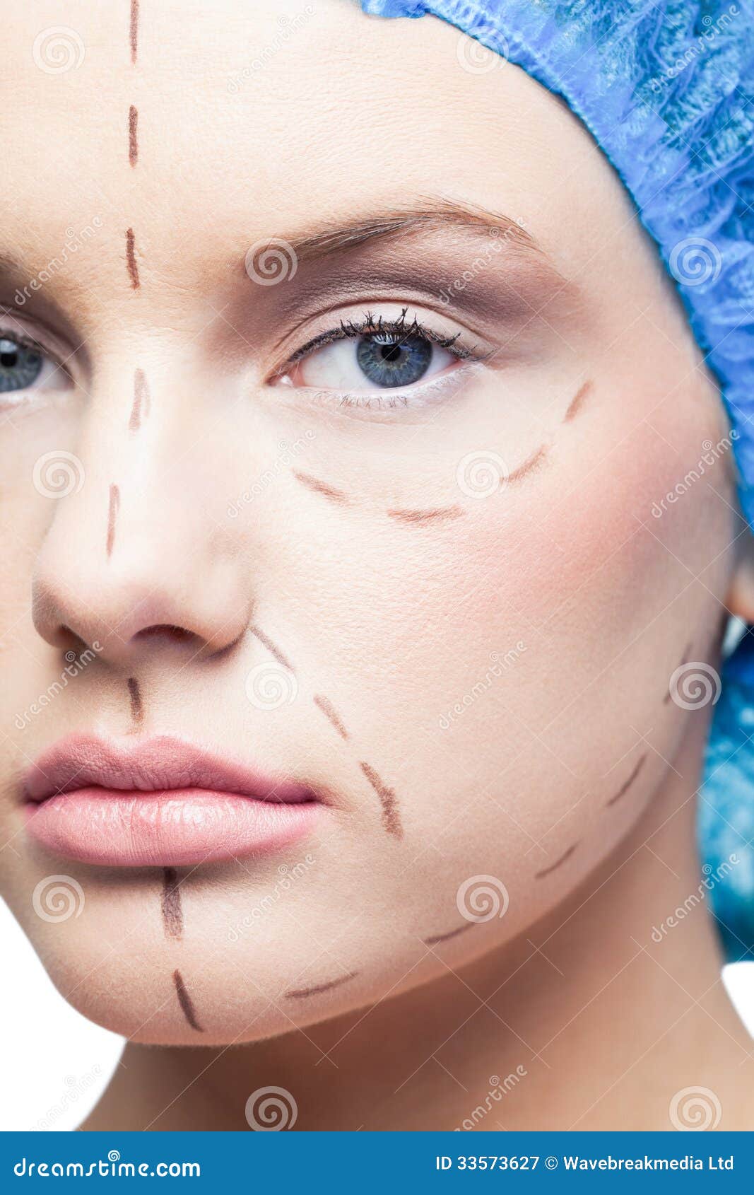 Close Up on Relaxed Young Patient with Dotted Lines on the Face Stock ...