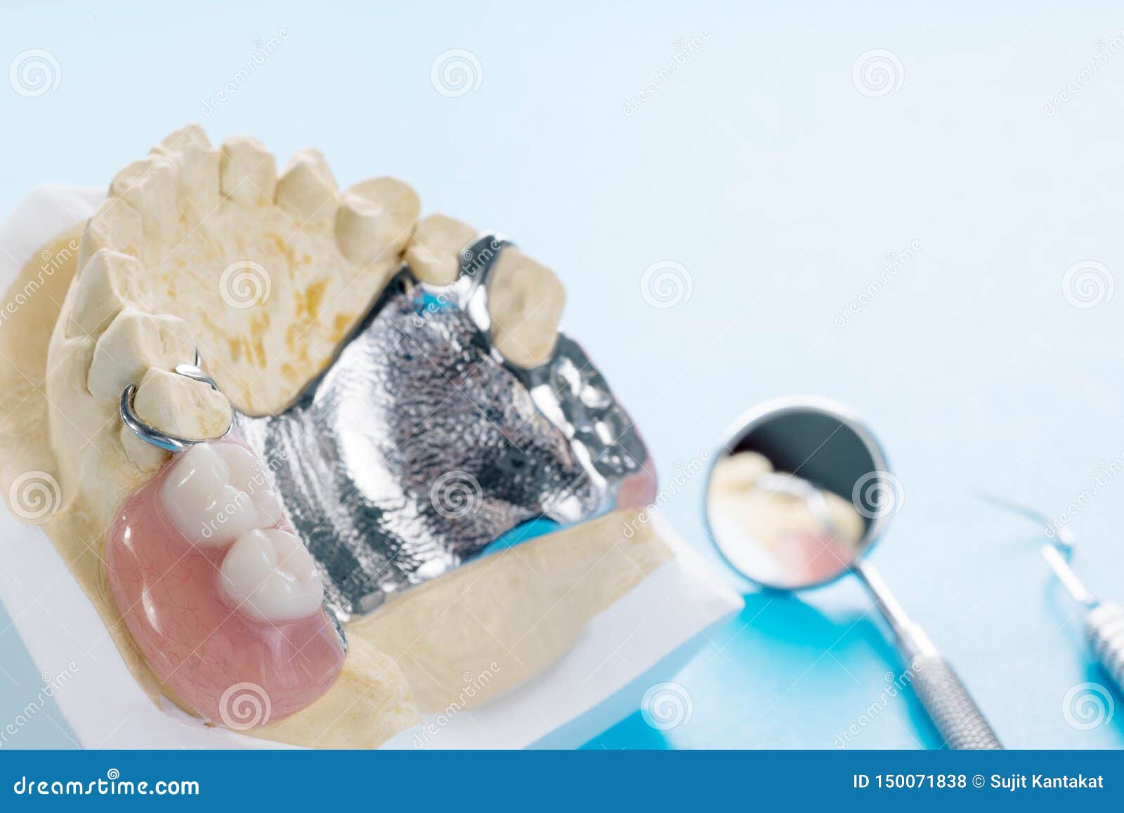 Removable Partial Denture RPD. Stock Photo - Image of clean, background ...