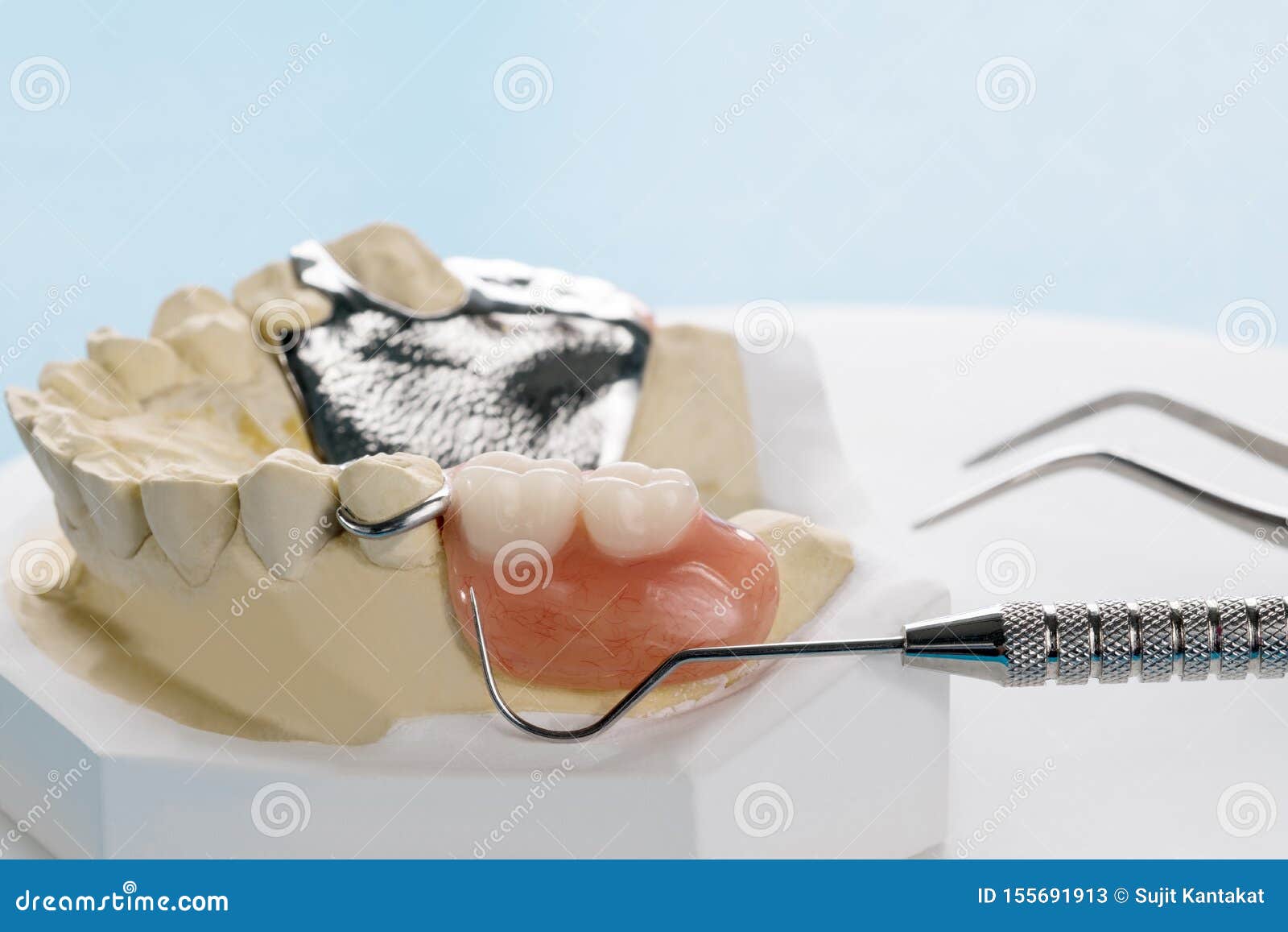 Removable Partial Denture RPD. Stock Image - Image of dentures, plate ...