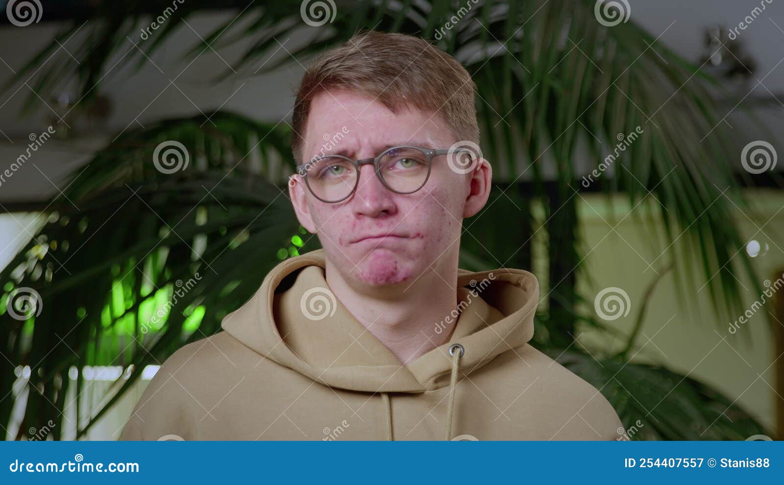 Close-up of a Sad Young Man with Glasses and Pimples on His Face ...