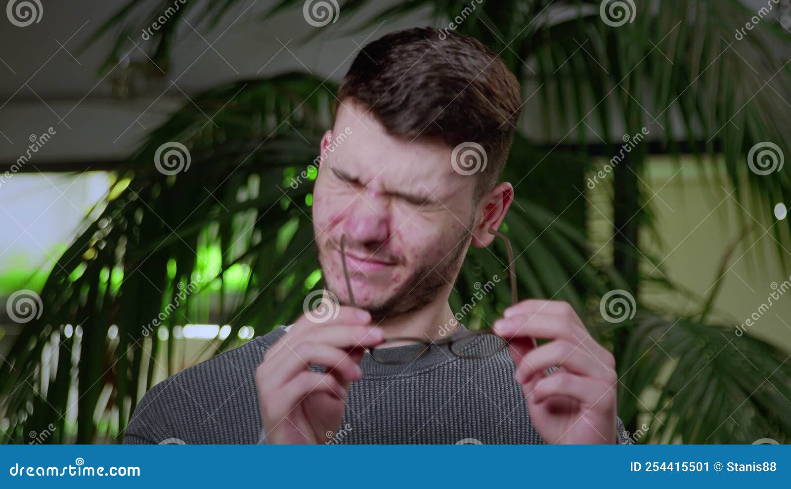 Close-up of a Sad Young Man with Glasses and Pimples on His Face ...