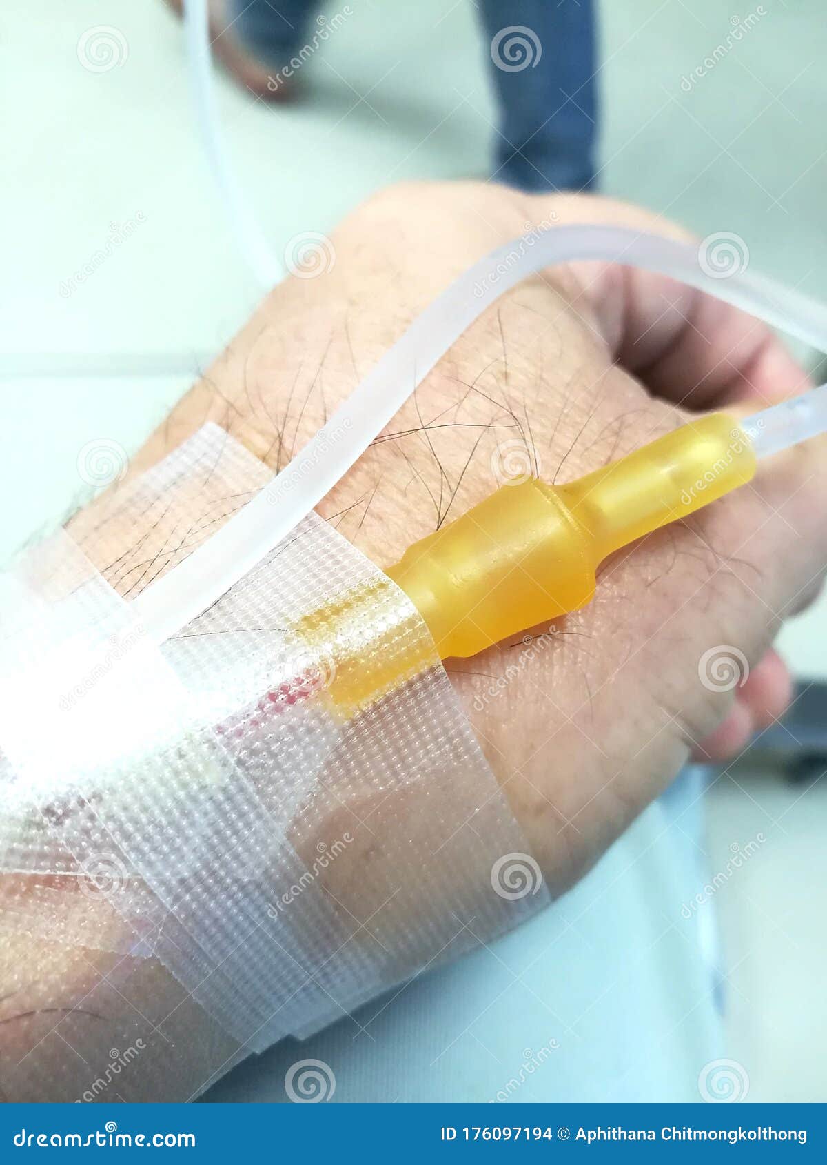 Close Up Saline Solution Line on Man Hand in Hospital. the Patient Get ...