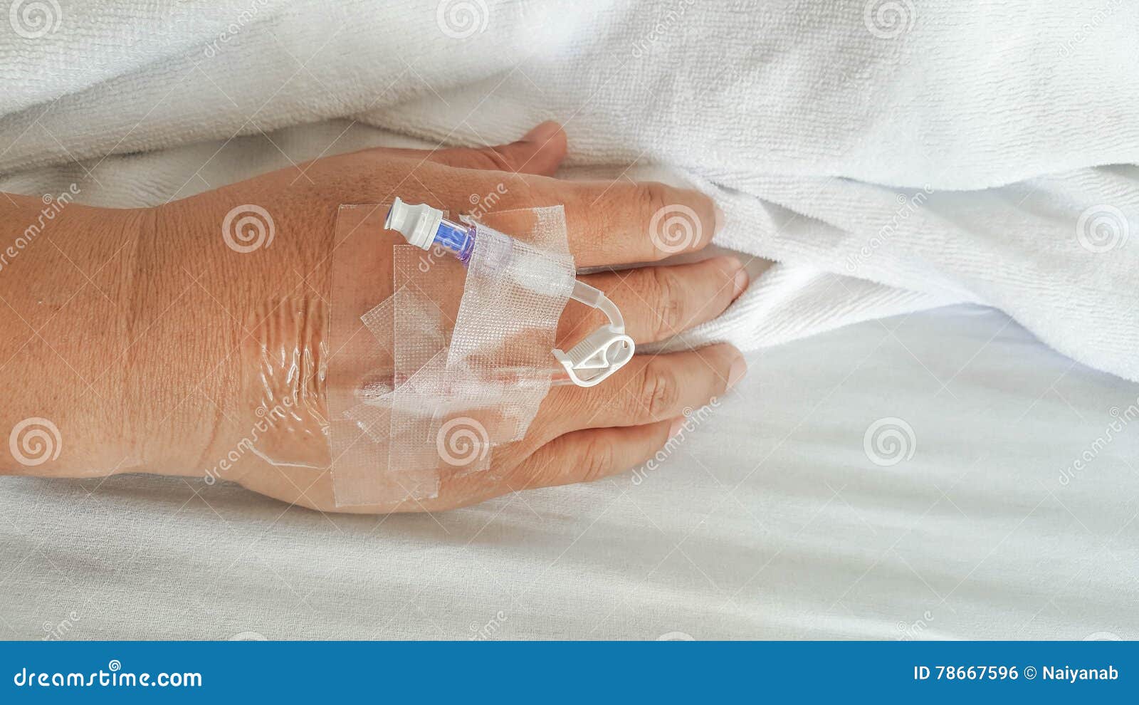Close Up of Saline Solution Preparation on Hand of Man Patient Stock ...