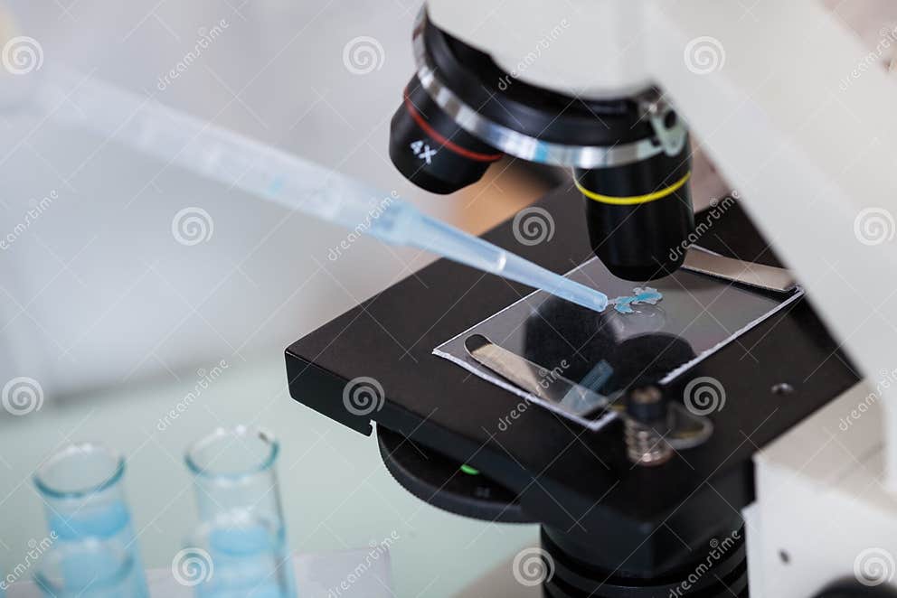 Close-up of Sample on Microscope Slide Stock Photo - Image of disease ...