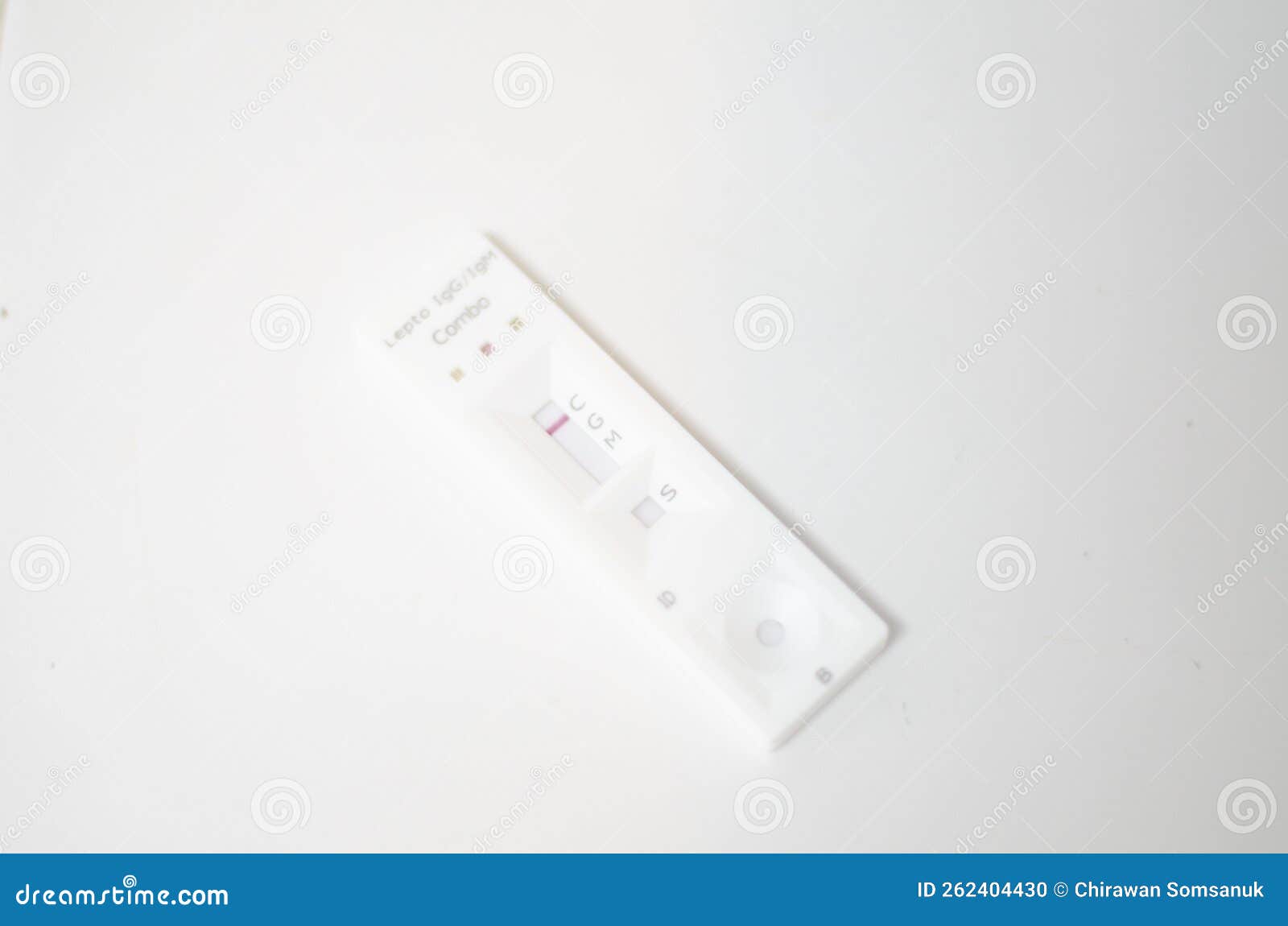 Close Up Scrub-typhous Testing in Lab Stock Photo - Image of clinic ...