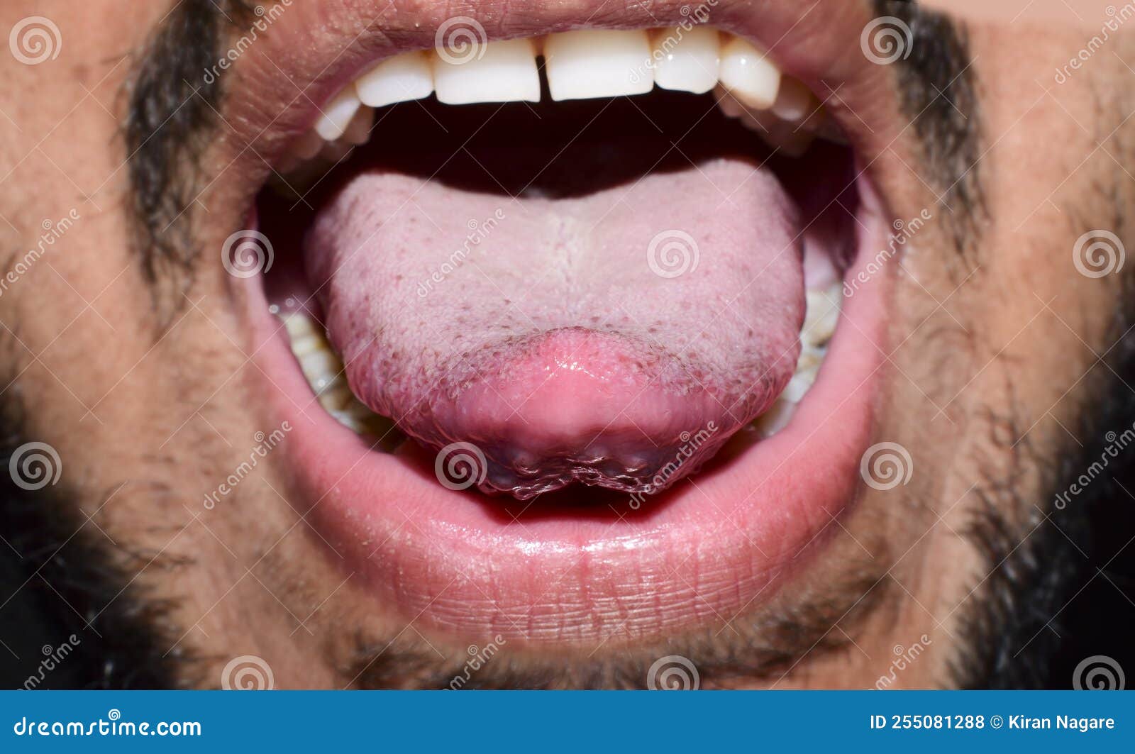 Awesome Healthy Teeth Smile Stock Photo - Image of female, healthcare ...