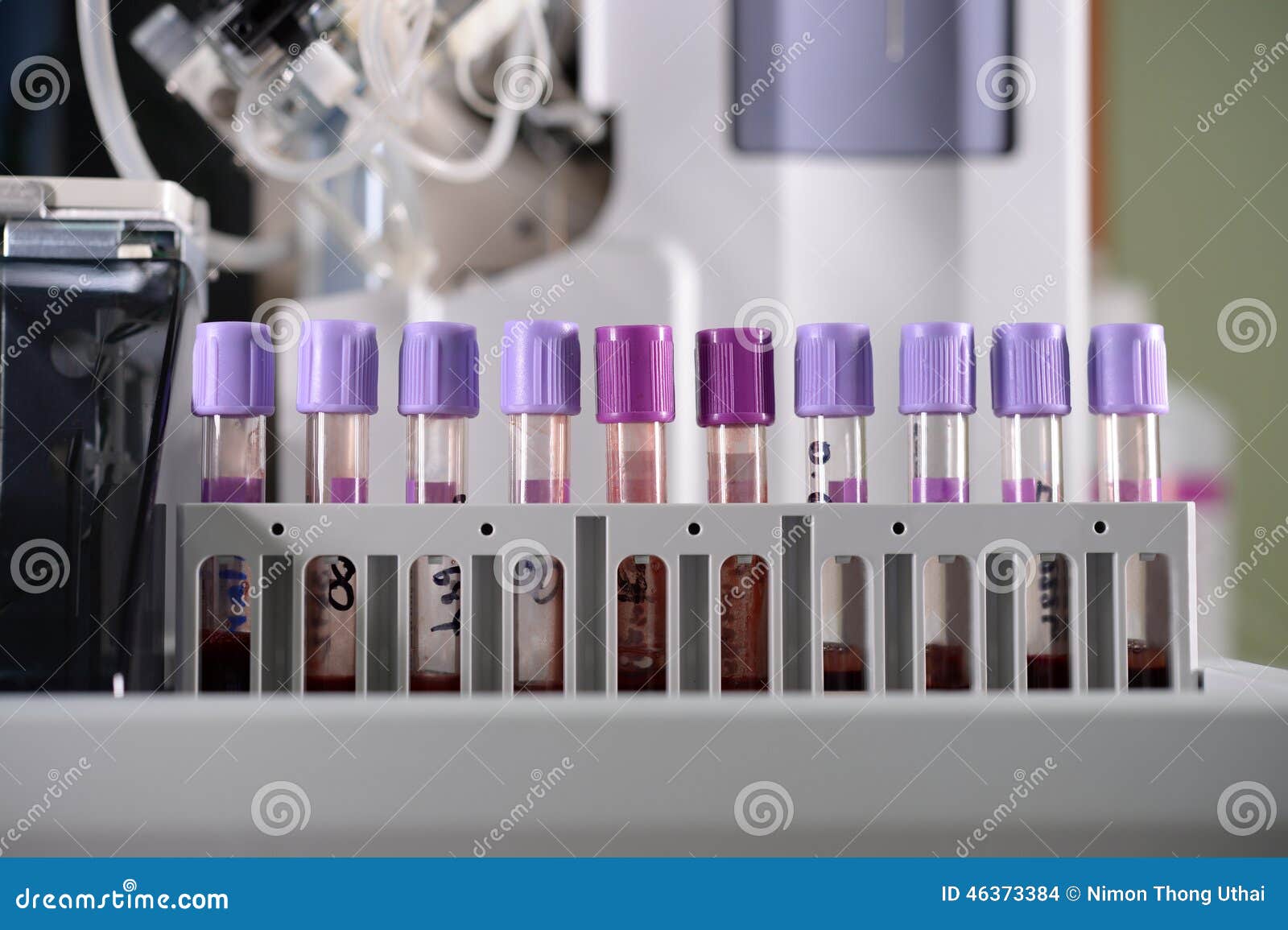 Close Up Shot of Blood Test Machine Stock Photo - Image of acid ...