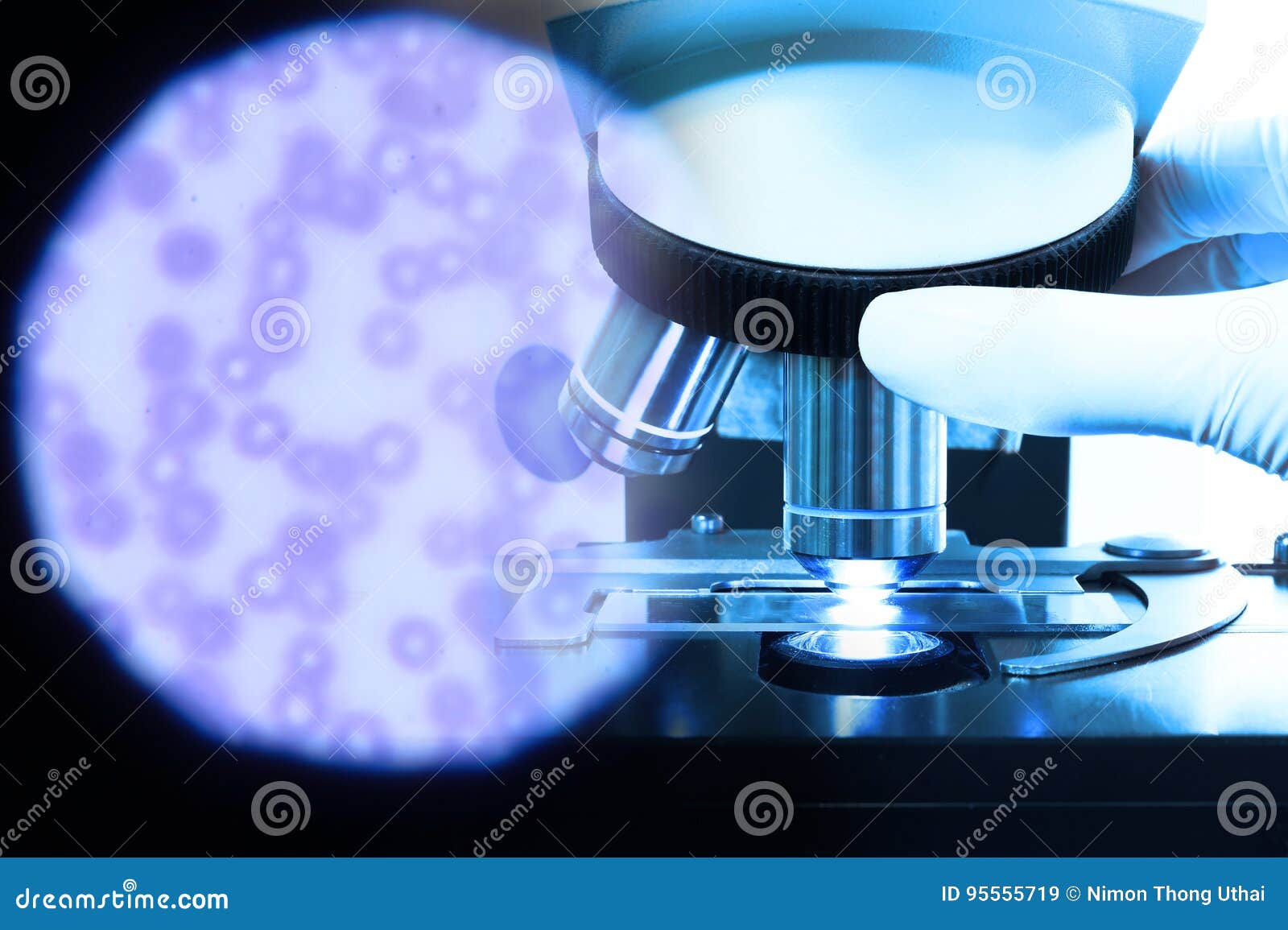 Close Up Shot of Microscope at the Blood Laboratory and Red Blood Cells ...