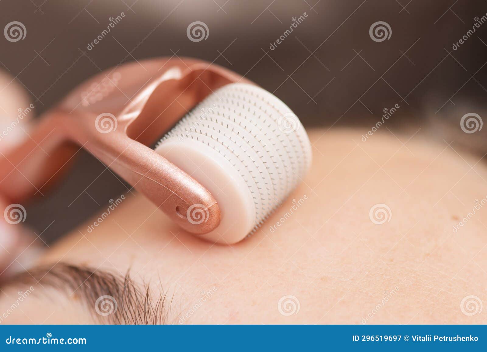 Microneedle Mesotherapy in Cosmetology Salon, Introduction of ...