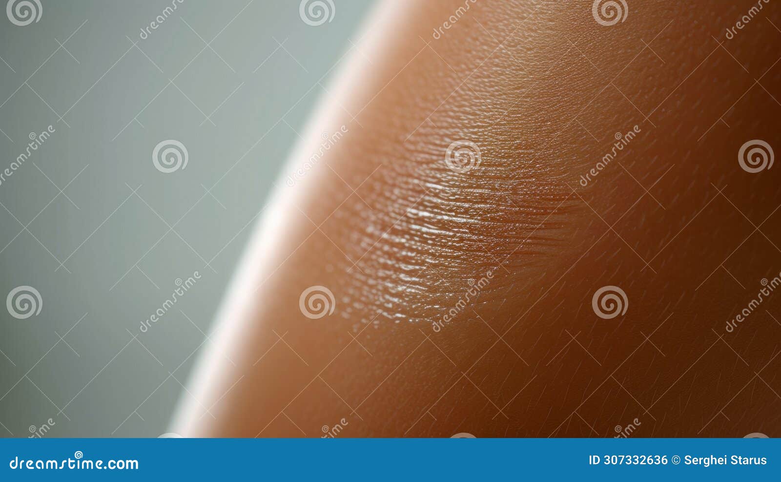 A Close Up of a Skinned Knee with Some Sort of Rash, AI Stock ...