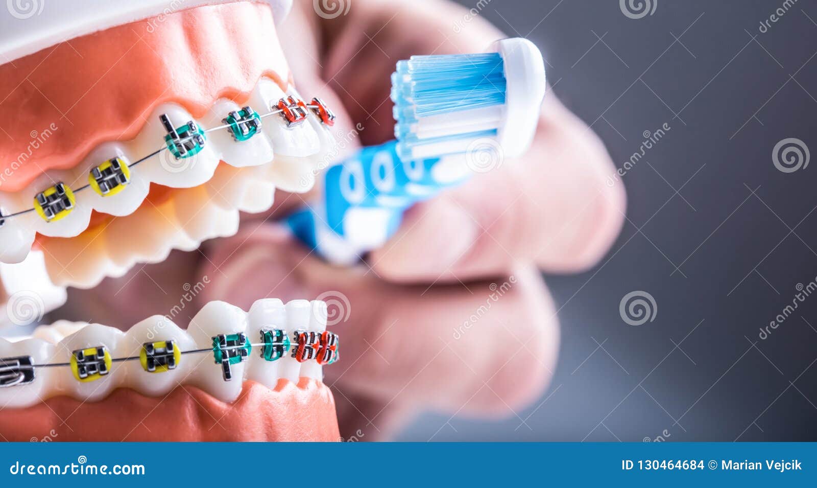 Close-up Teeth Braces and Tooth Brush As an Example of Toothbrushing ...