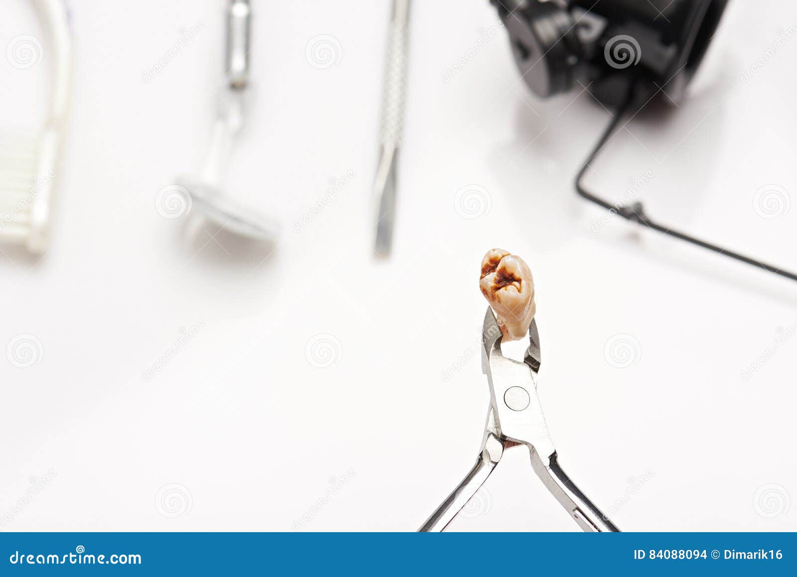 Close Up of Teeth with Cavity Stock Photo - Image of dentistry, dentist ...