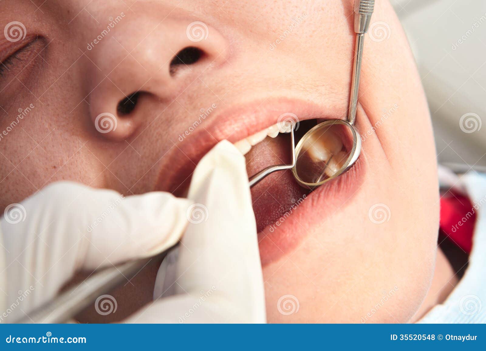 Close up teeth examination stock photo. Image of clinic - 35520548