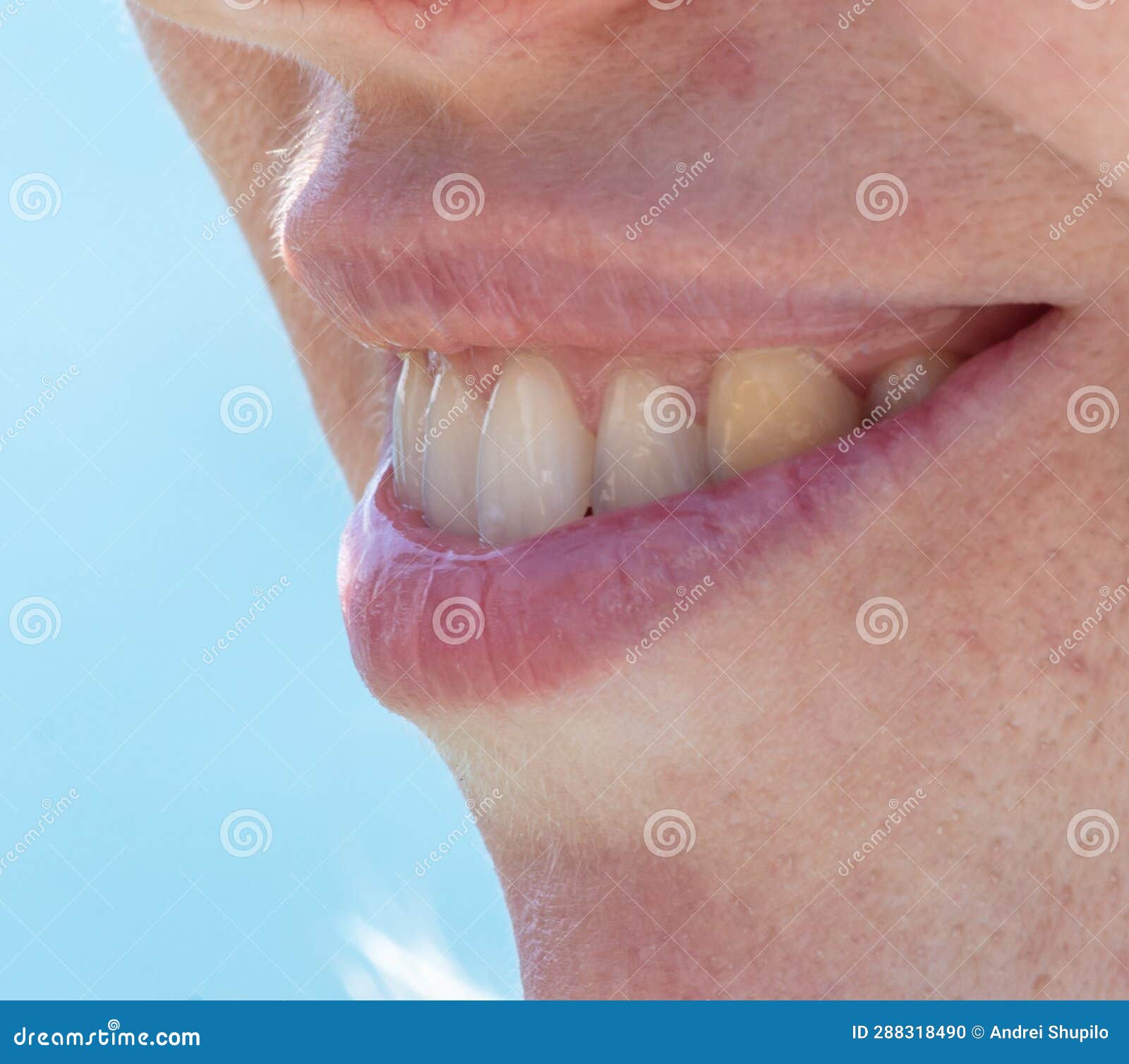 Close-up of Teeth and Smile of a Girl. Macro Stock Photo - Image of ...