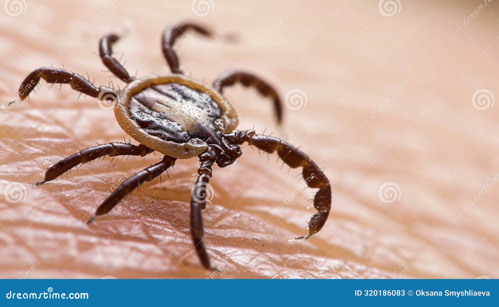 Crawling Tick On Human Skin Background. Stock Photo | CartoonDealer.com ...