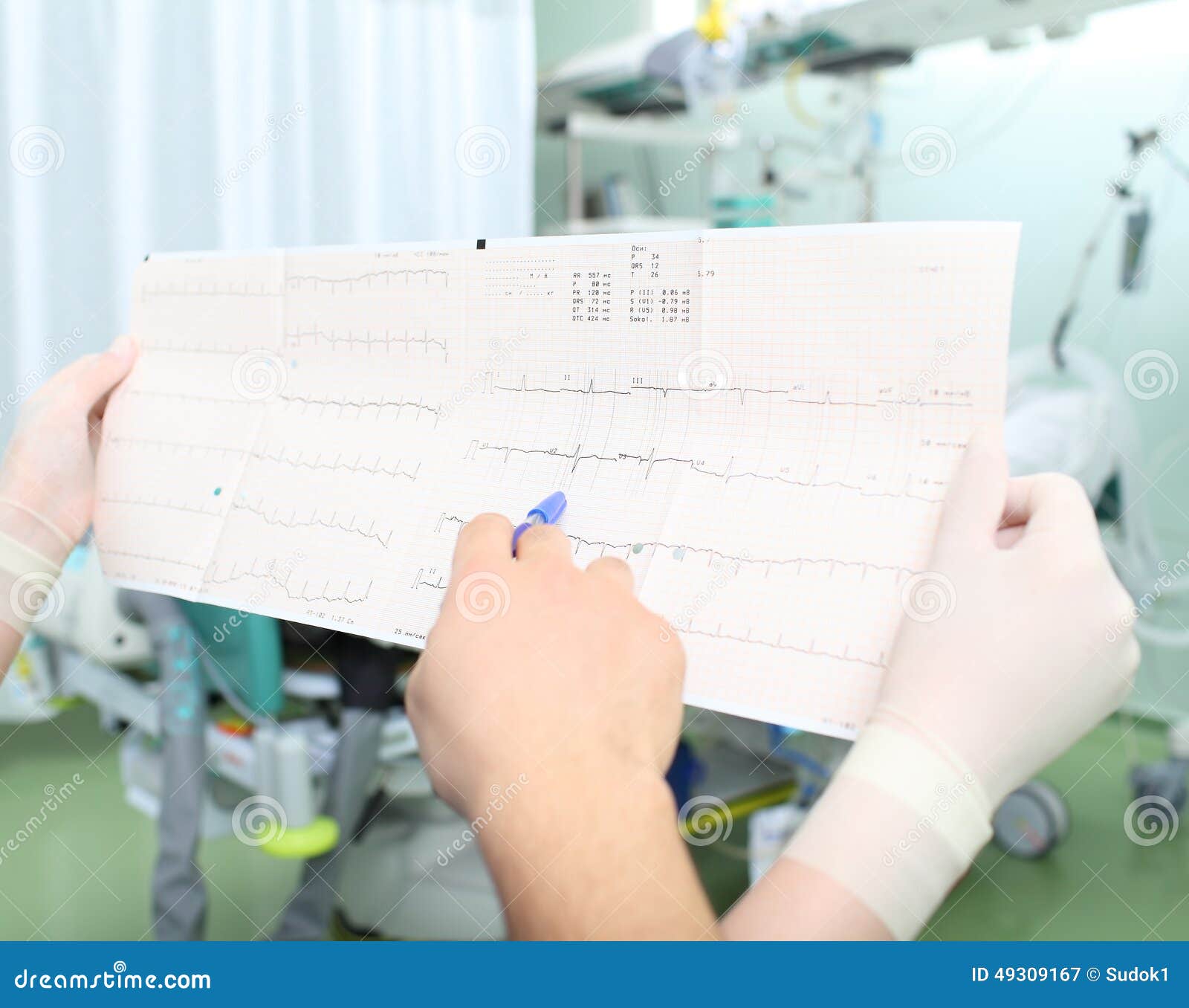 Close Up Of ECG Cardiogram Pulse Graph On A Paper. Medical Examination ...