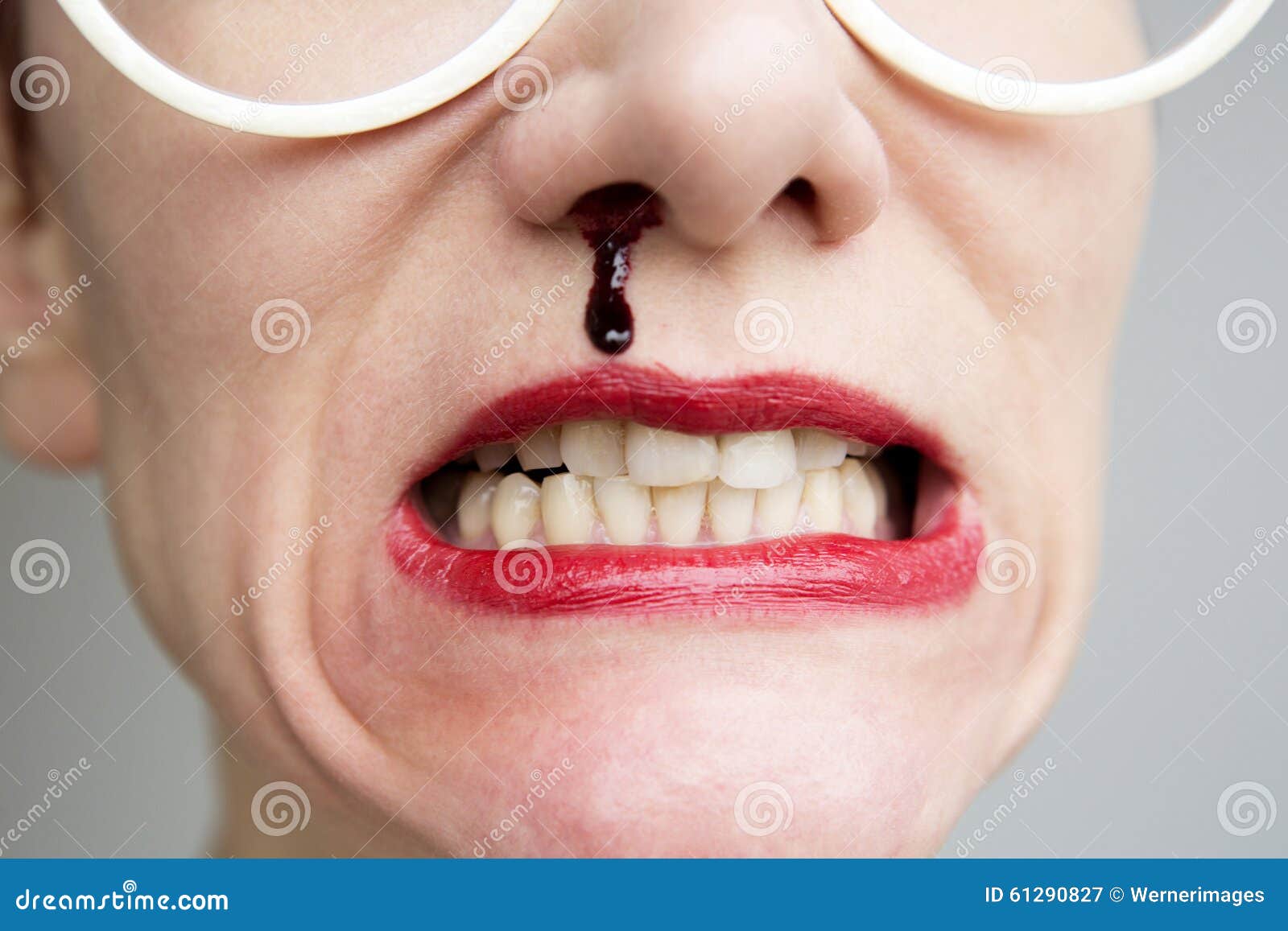 Close-up Van Vrouw Met Neusbloeding Stock Afbeelding - Image of ...