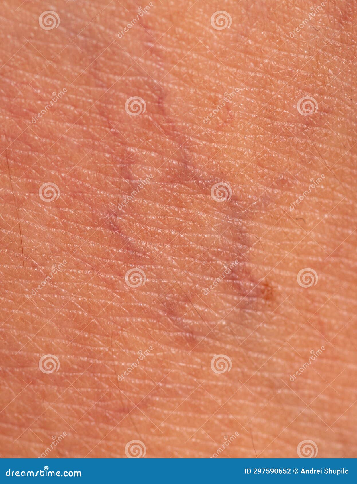 Close-up of Veins on the Skin. Macro Stock Photo - Image of female ...