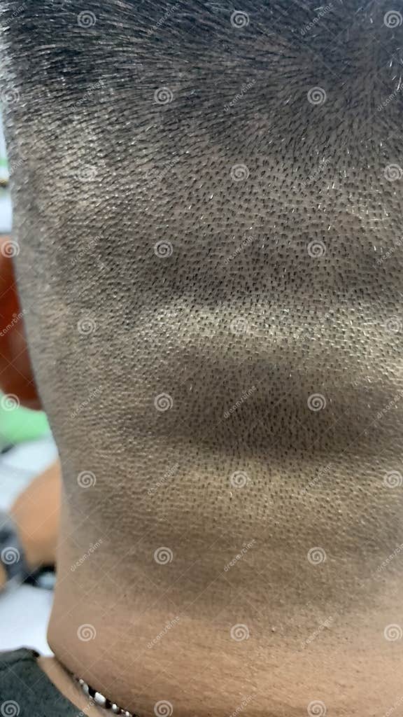 Close Up View of the Back of a Man S Head Stock Photo - Image of human ... Close Up View of the Back of a Man S Head Stock Photo - Image of human ...