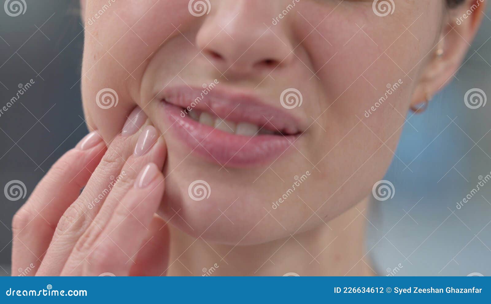 Close Up of Woman Having Toothache, Cavity Stock Photo - Image of teeth ...