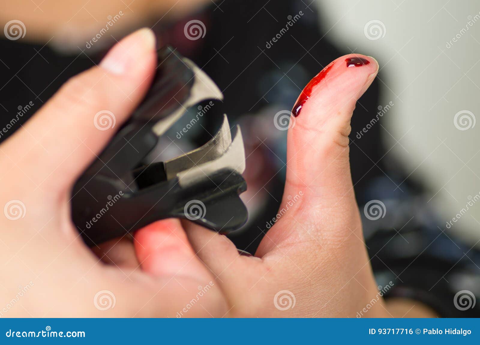 Close Up of a Woman Injured Her Finger Using a Black Staple Puller ...