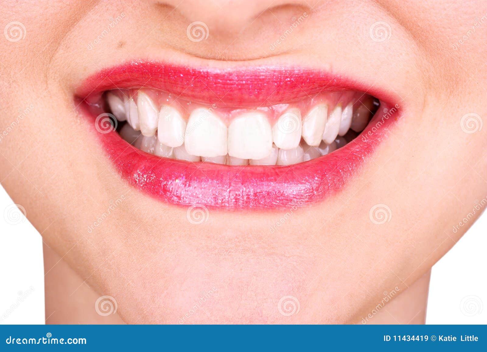 Close Up of a Woman S Smile Stock Image - Image of teeth, lady: 11434419