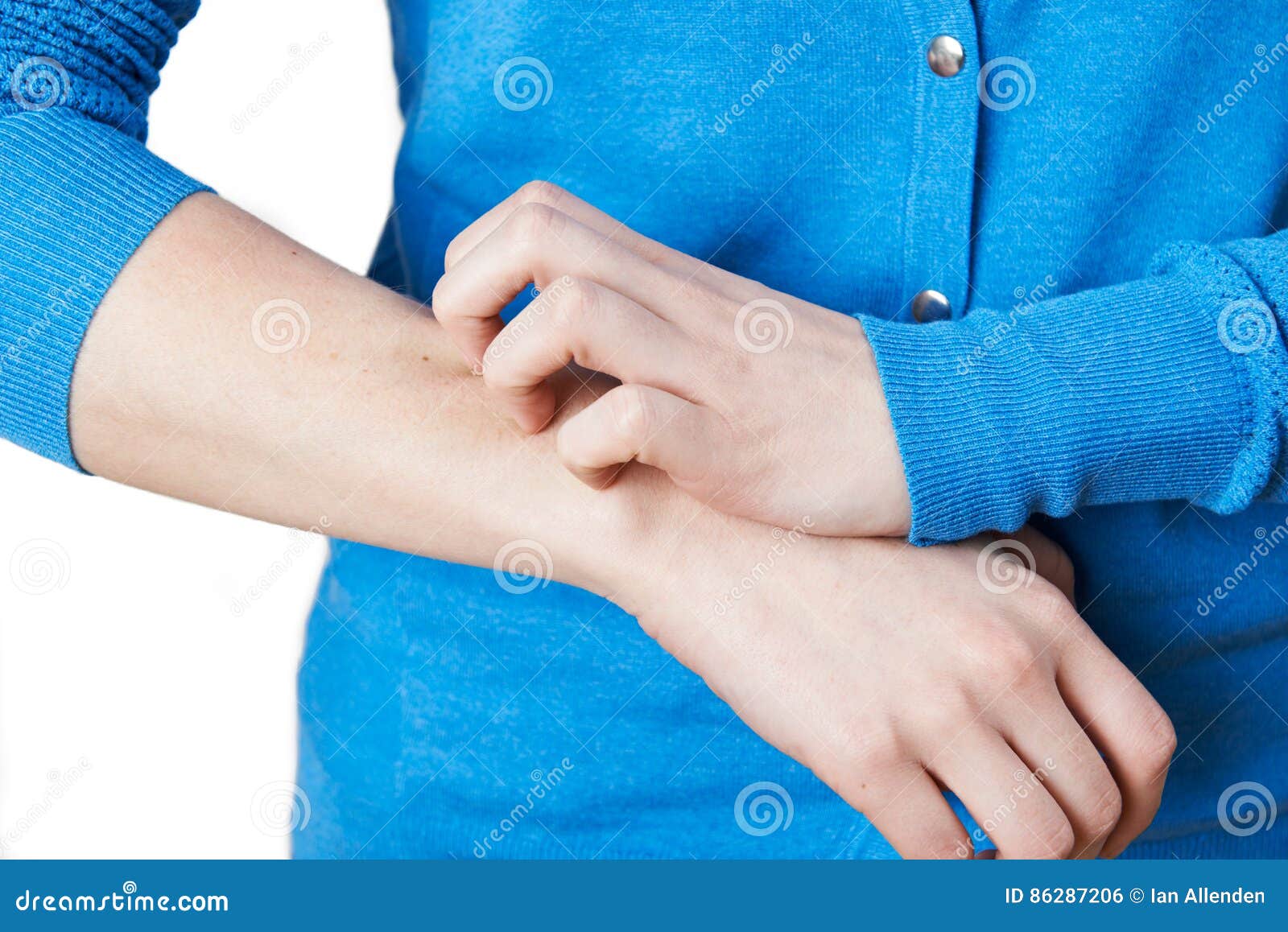 Close Up of Woman Scratching Arm Stock Photo - Image of dermatology ...