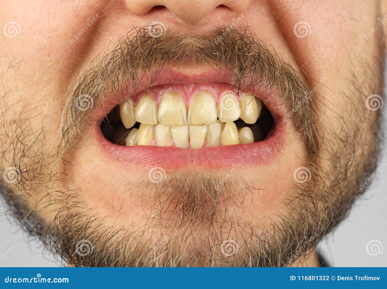 Closed Human Teeth Grin, Closeup Stock Photo - Image of mouth, care ...