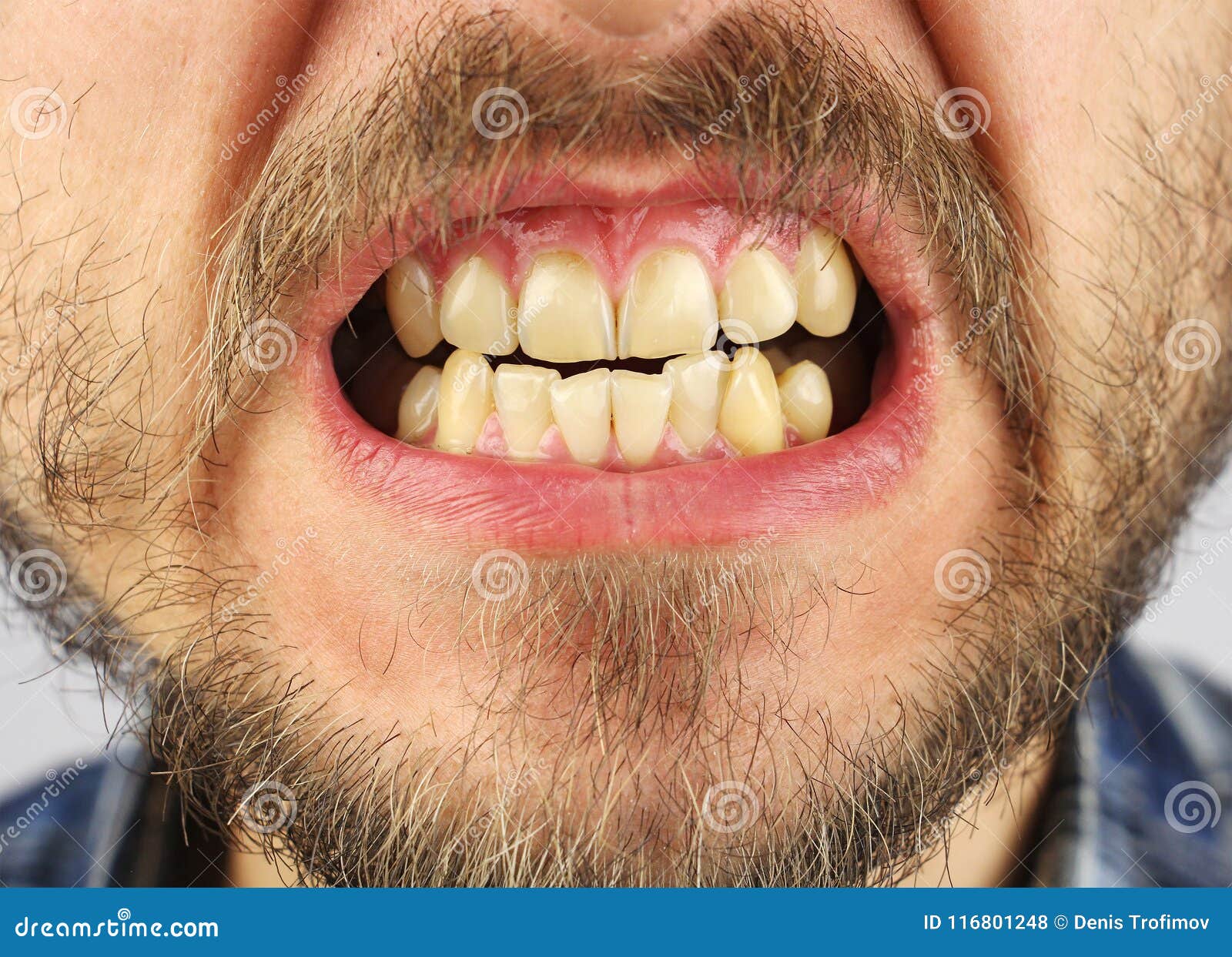 Closed Human Teeth Grin, Small Gap, Closeup Stock Photo - Image of ...