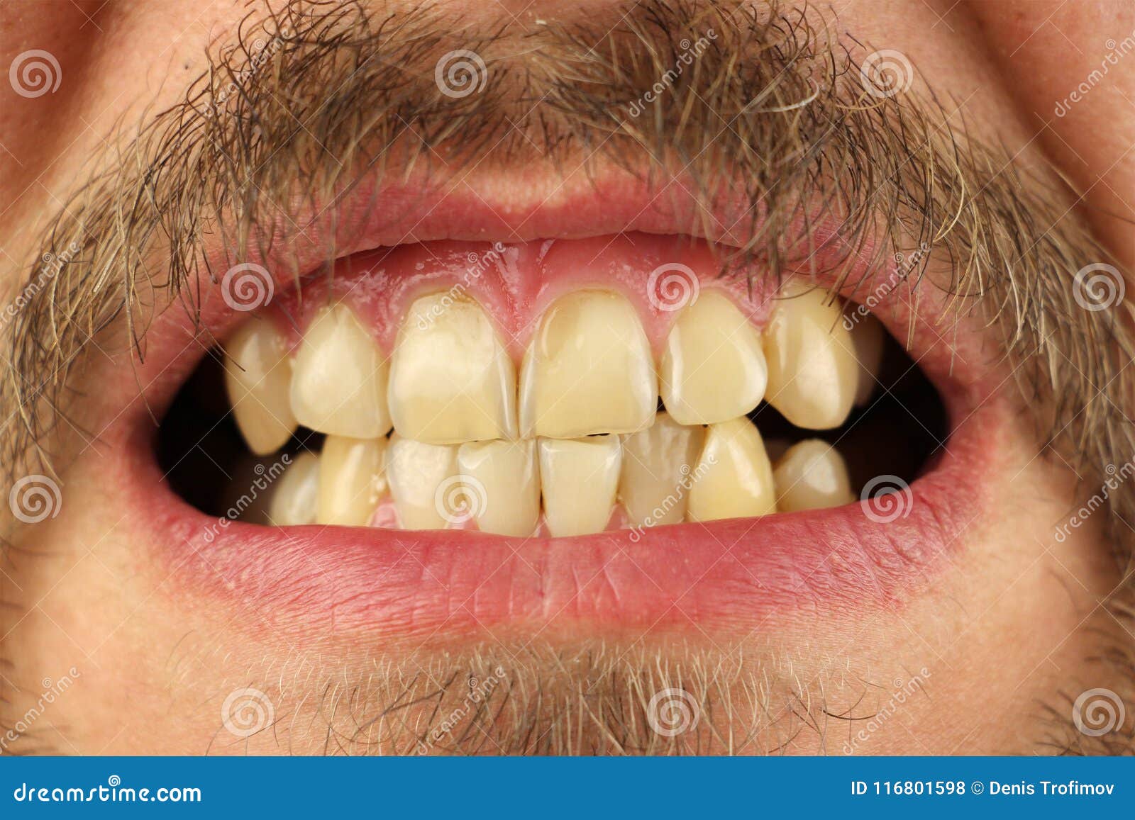 Closed Human Teeth Grin, Macro Stock Photo - Image of dental, hygiene ...