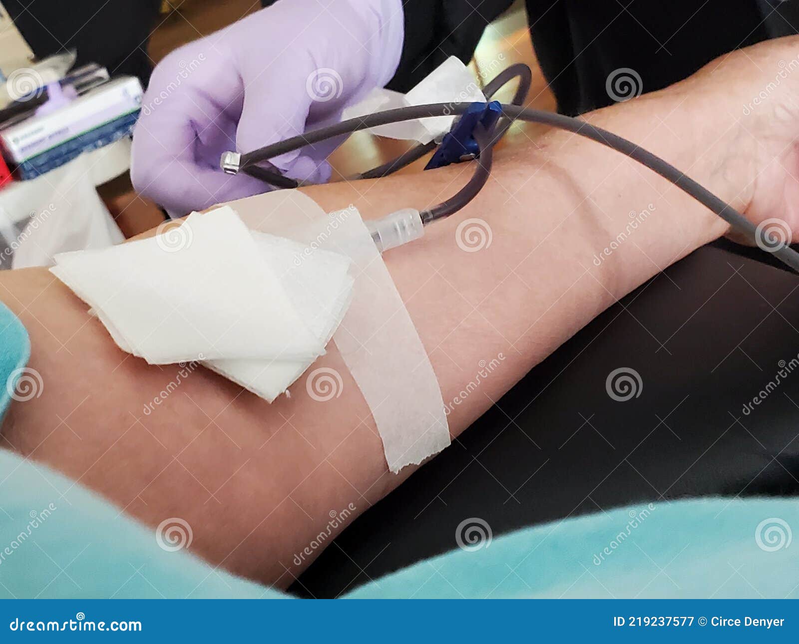 Closeup of Arm while Donating Whole Blood Stock Image - Image of nurse ...